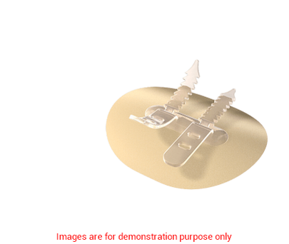 CathGrip Universal Securement Device - Box of 30